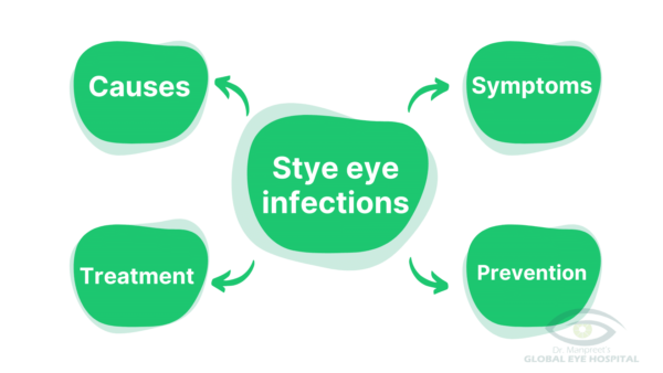 Causes, Symptoms, Treatment and prevention of Stye eye infections ...
