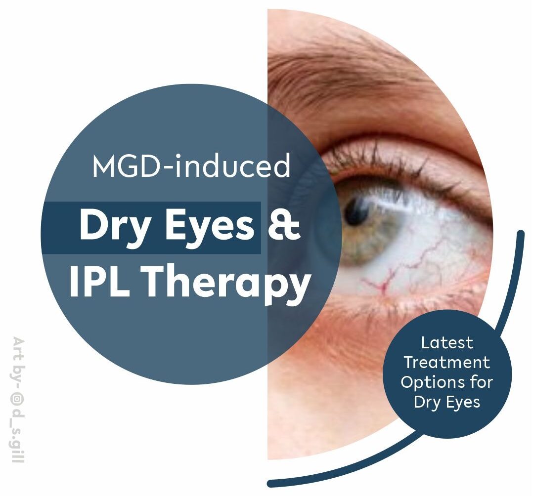 Dry Eye - Global Eye Hospital: Treat Yourself at Best Eye Hospital